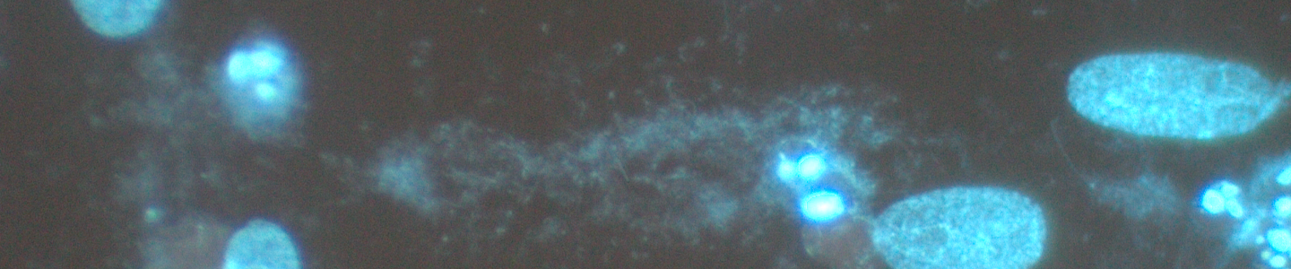 Mycoplasma Contamination Is Insidious | ATCC