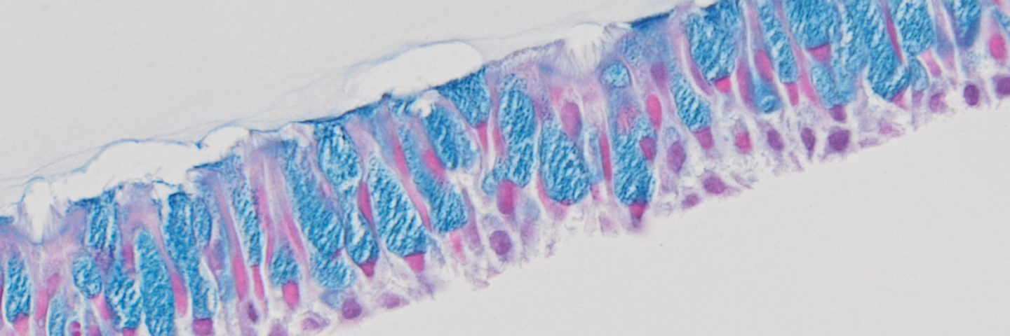 Evaluating Airway ALI Model Fabrication Methods | ATCC