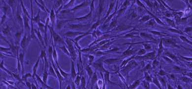 Human Mesenchymal Stem Cells | ATCC