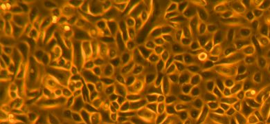 ATCC Human Bronchial-Tracheal Epithelial Cells | ATCC