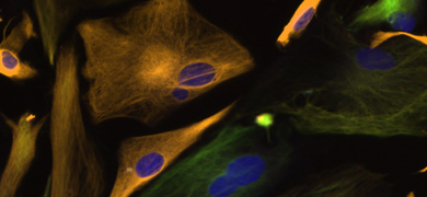 Neural progenitor cells | ATCC