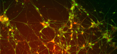 Neurosphere Culture from Neural Progenitor Cells | ATCC