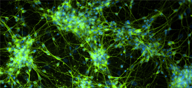 Neurosphere Culture from Neural Progenitor Cells | ATCC