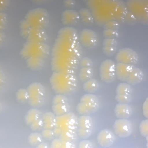 Mycobacterium sp. | ATCC