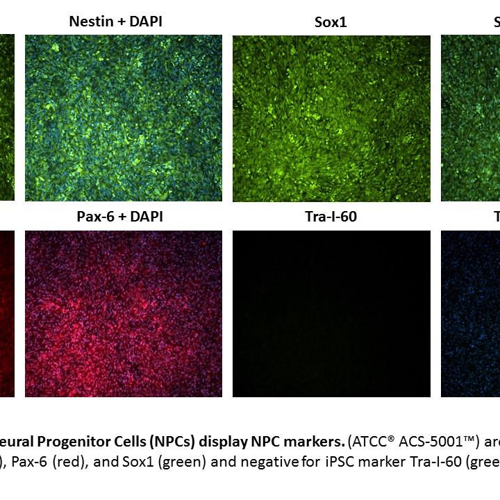 Neural Progenitor Cells Derived from ATCC-DYS0530 Parkinson's Disease ...
