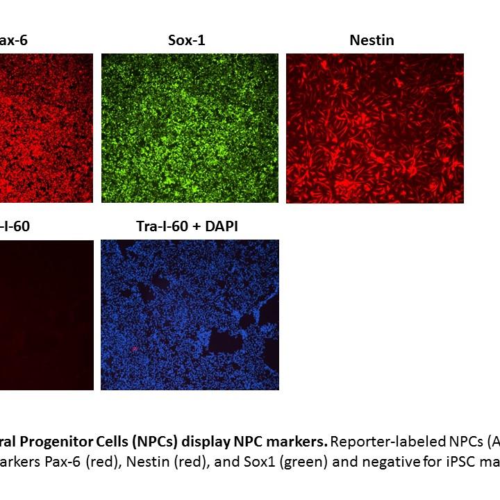 Neural Progenitor Cells Derived from XCL-1 MAP2p-Nanoluc-Halotag - ACS ...