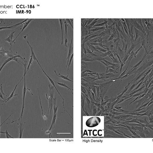 IMR-90 - CCL-186 | ATCC