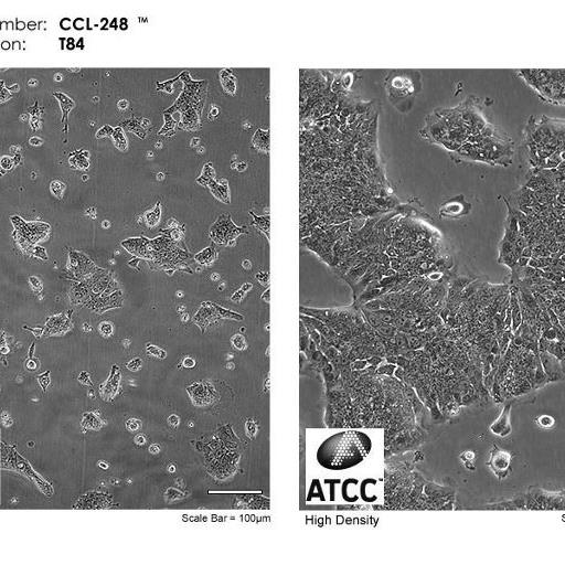 T84 - CCL-248 | ATCC