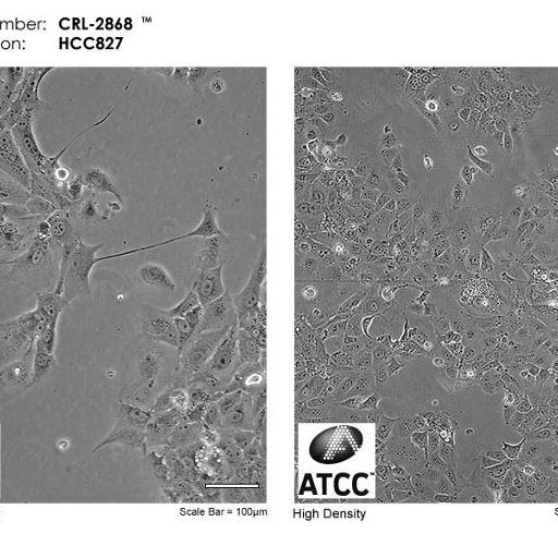 HCC827 - CRL-2868 | ATCC