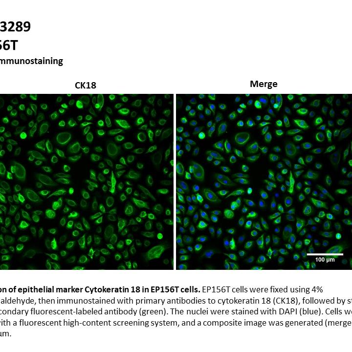 hTERT EP156T - CRL-3289 | ATCC