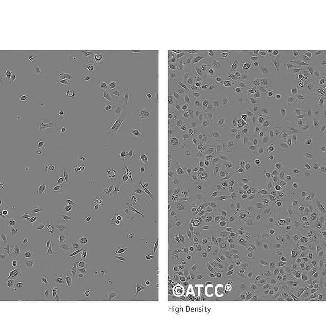 hTERT EP156T - CRL-3289 | ATCC