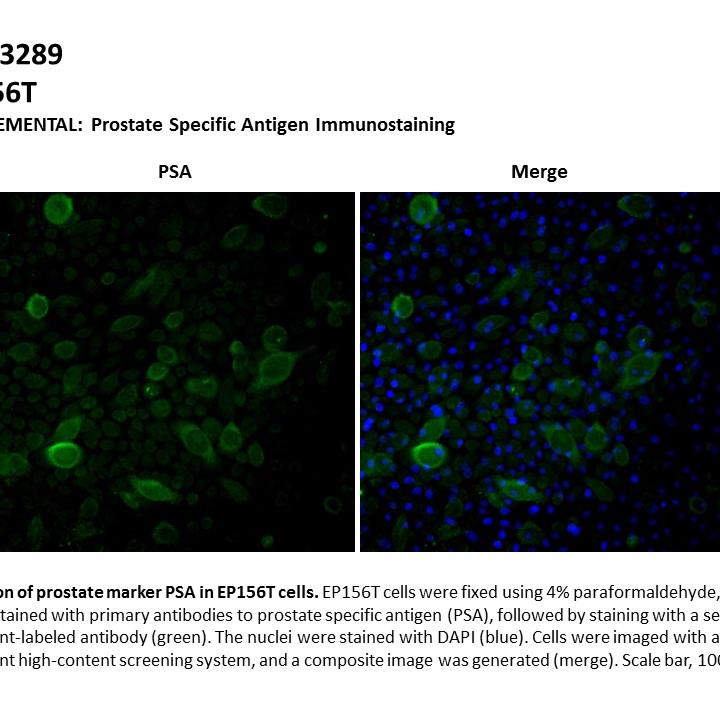 hTERT EP156T - CRL-3289 | ATCC