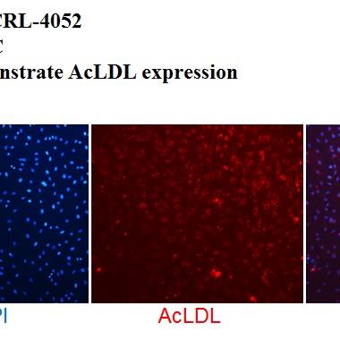 TeloHAEC - CRL-4052 | ATCC