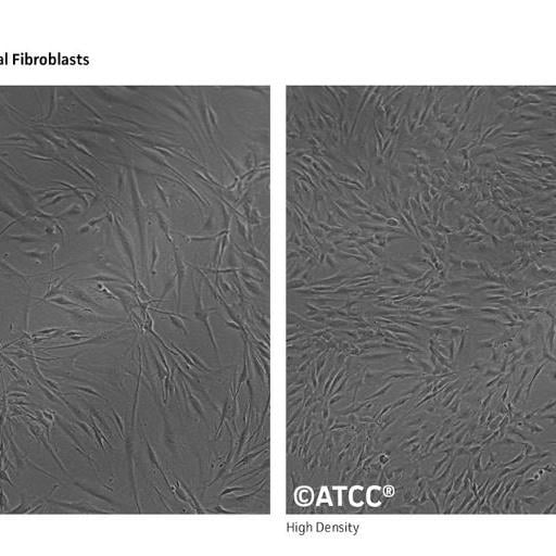 Primary Gingival Fibroblast; Normal, Human, Adult (HGF) - PCS-201-018 ...