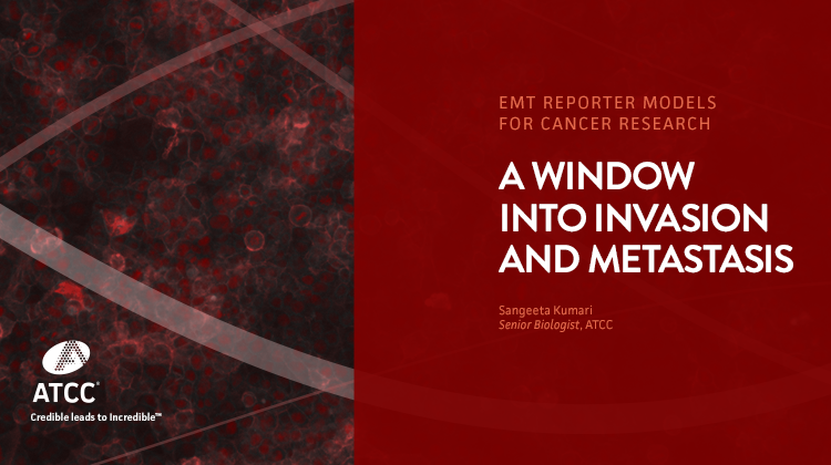 EMT Reporter Models for Cancer Research: A Window into Invasion and ...