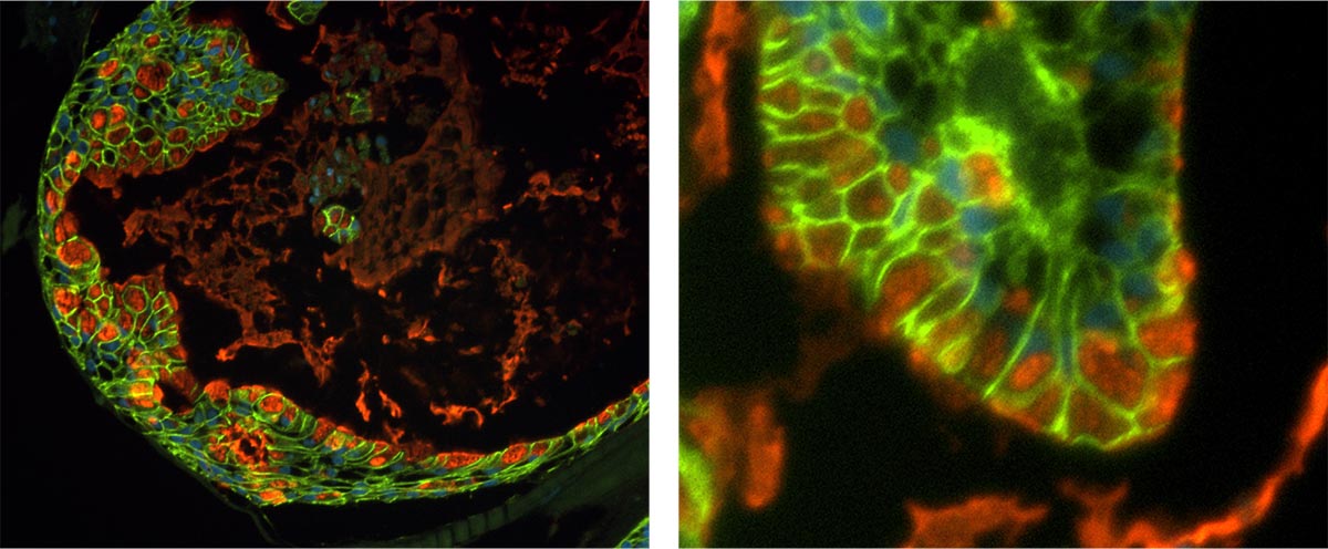 Directed Differentiation of Gastrointestinal Epithelial Organoids | ATCC