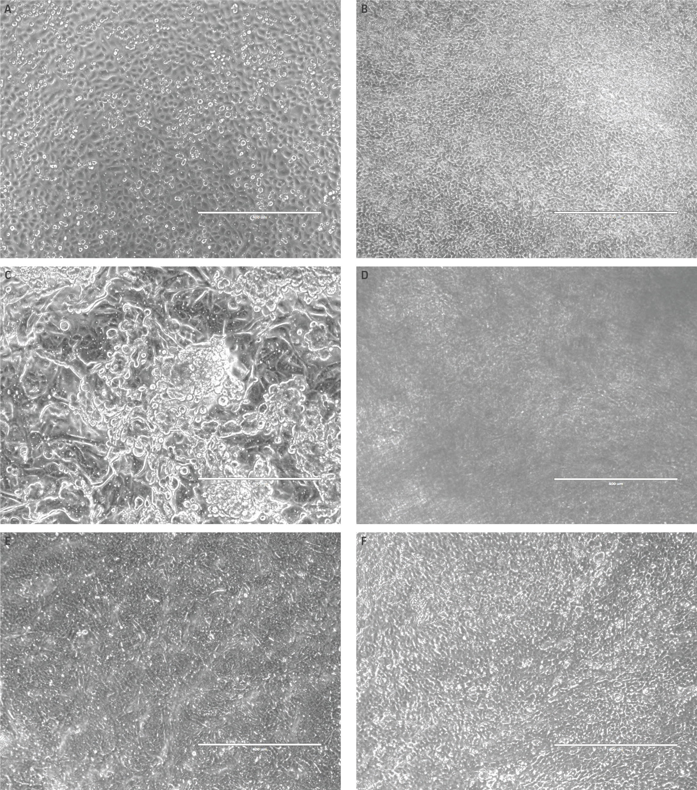 Evaluating Airway ALI Model Fabrication Methods | ATCC