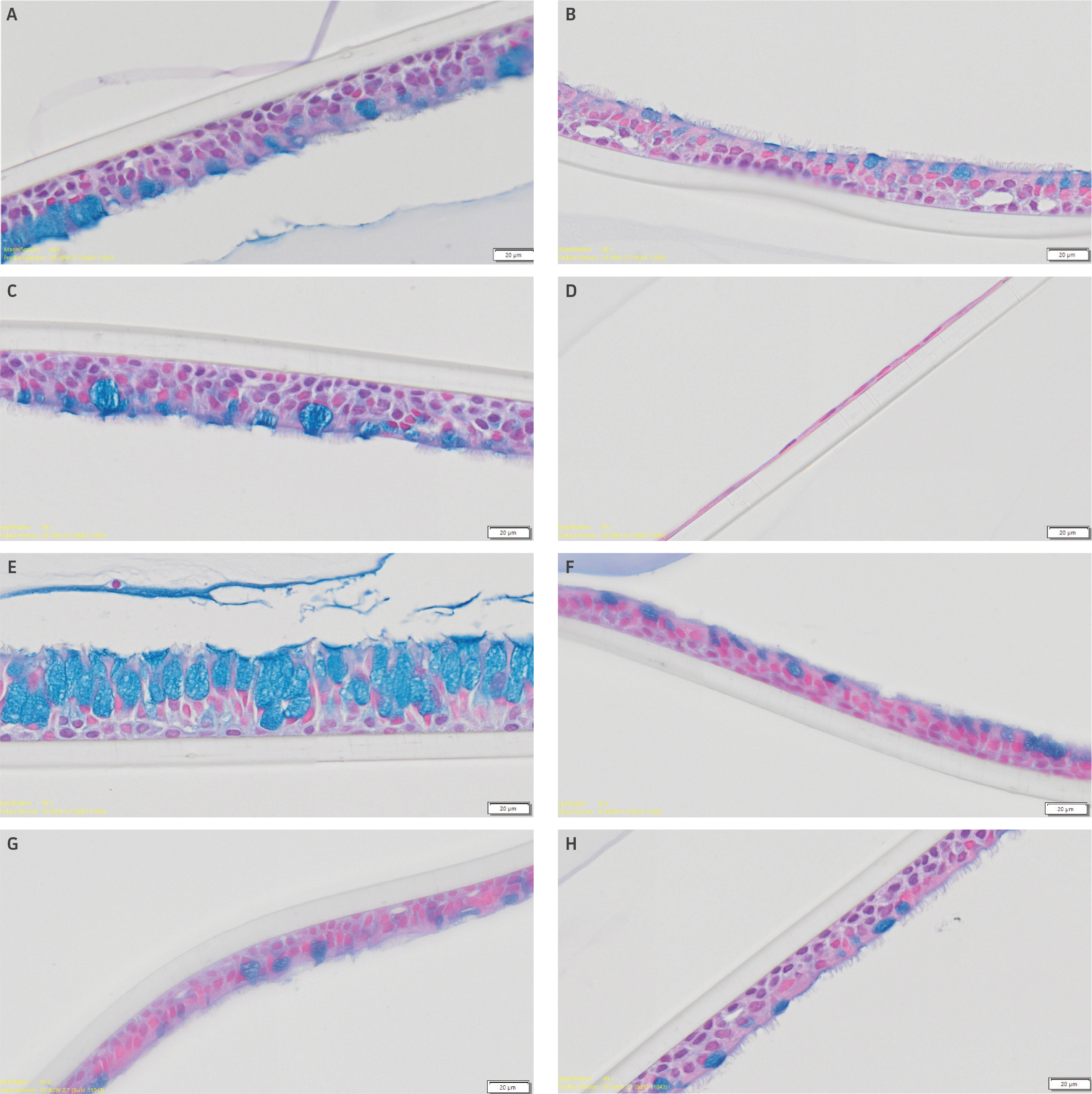 Evaluating Airway ALI Model Fabrication Methods | ATCC