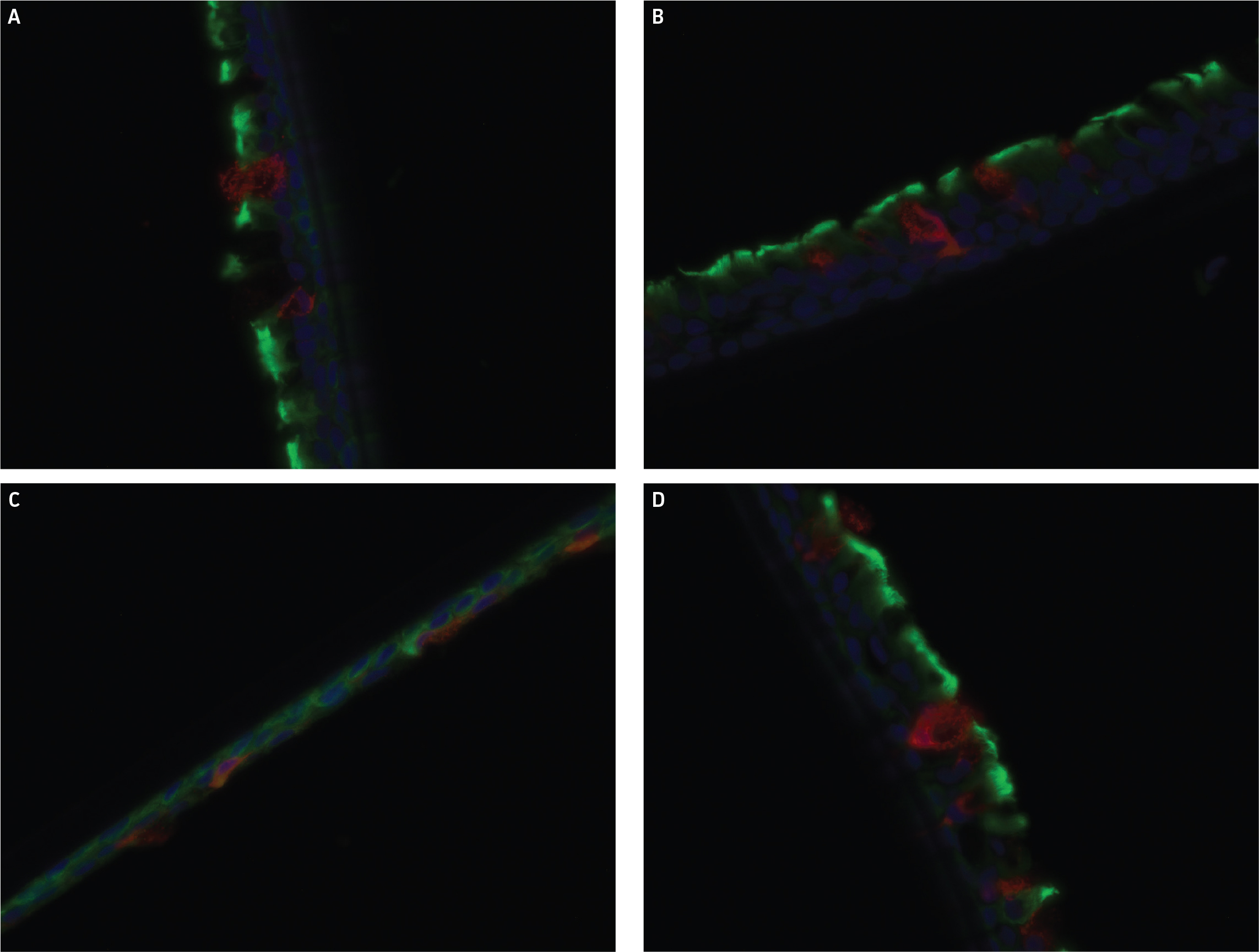 Evaluating Airway ALI Model Fabrication Methods | ATCC