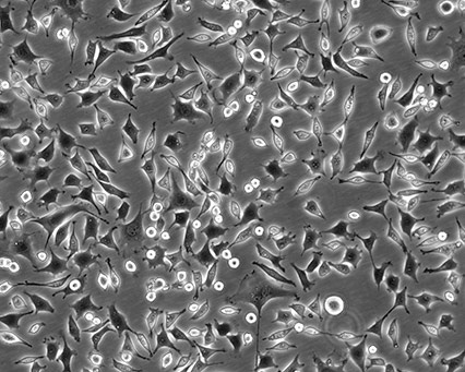 Cell Line Authentication Test Recommendations | ATCC