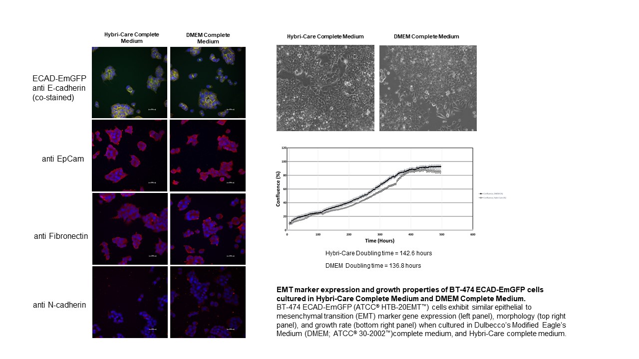 BT-474 ECAD-EmGFP - HTB-20EMT | ATCC