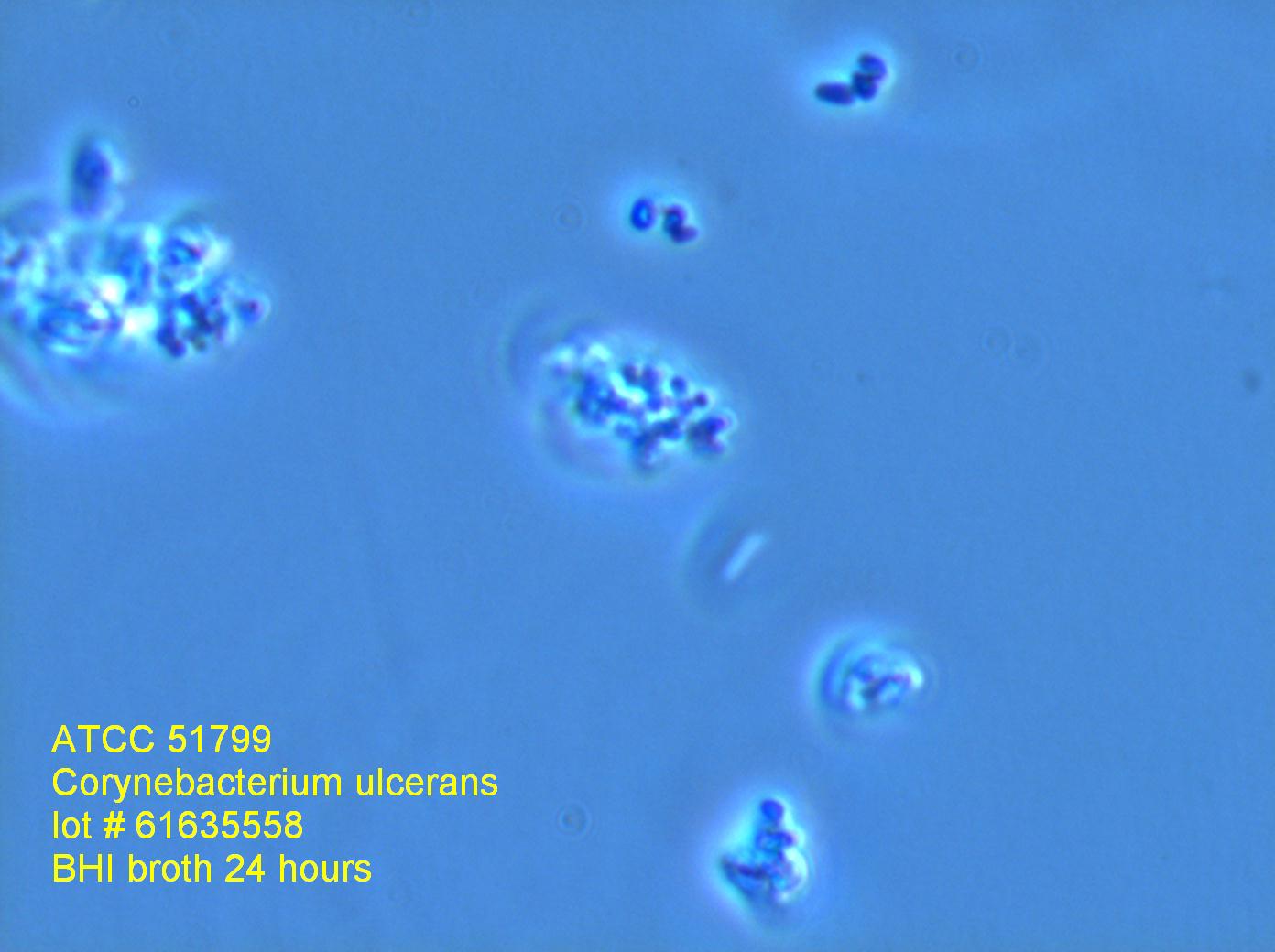 Corynebacterium ulcerans Riegel et al. - 51799 | ATCC