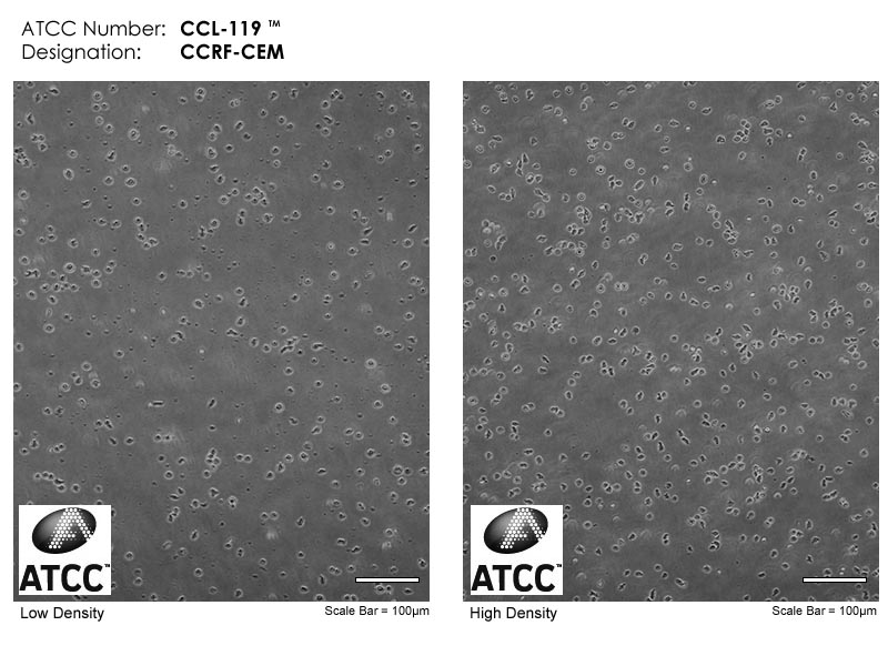 CCRF-CEM [CCRF CEM] - CCL-119 | ATCC