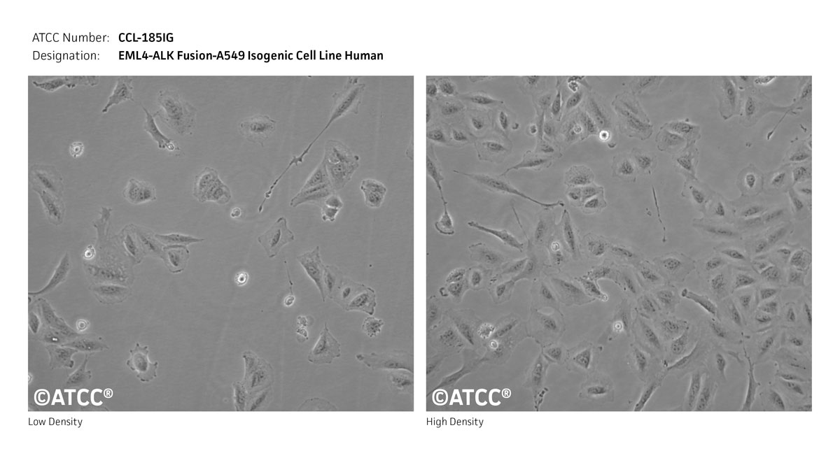 EML4-ALK Fusion-A549 Isogenic Cell Line Human - CCL-185IG | ATCC