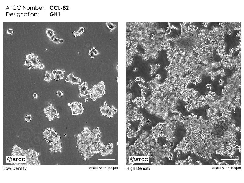 GH1 - CCL-82 | ATCC