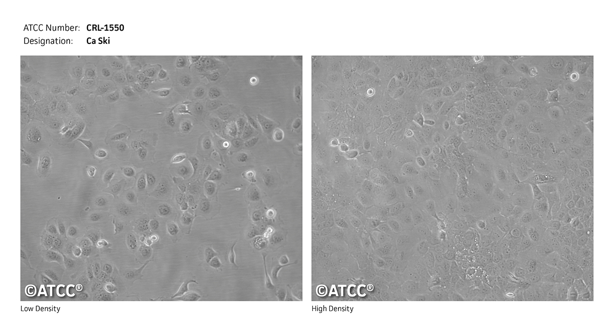 Ca Ski - CRL-1550 | ATCC