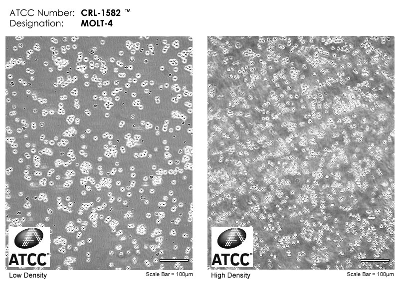 MOLT-4 - CRL-1582 | ATCC