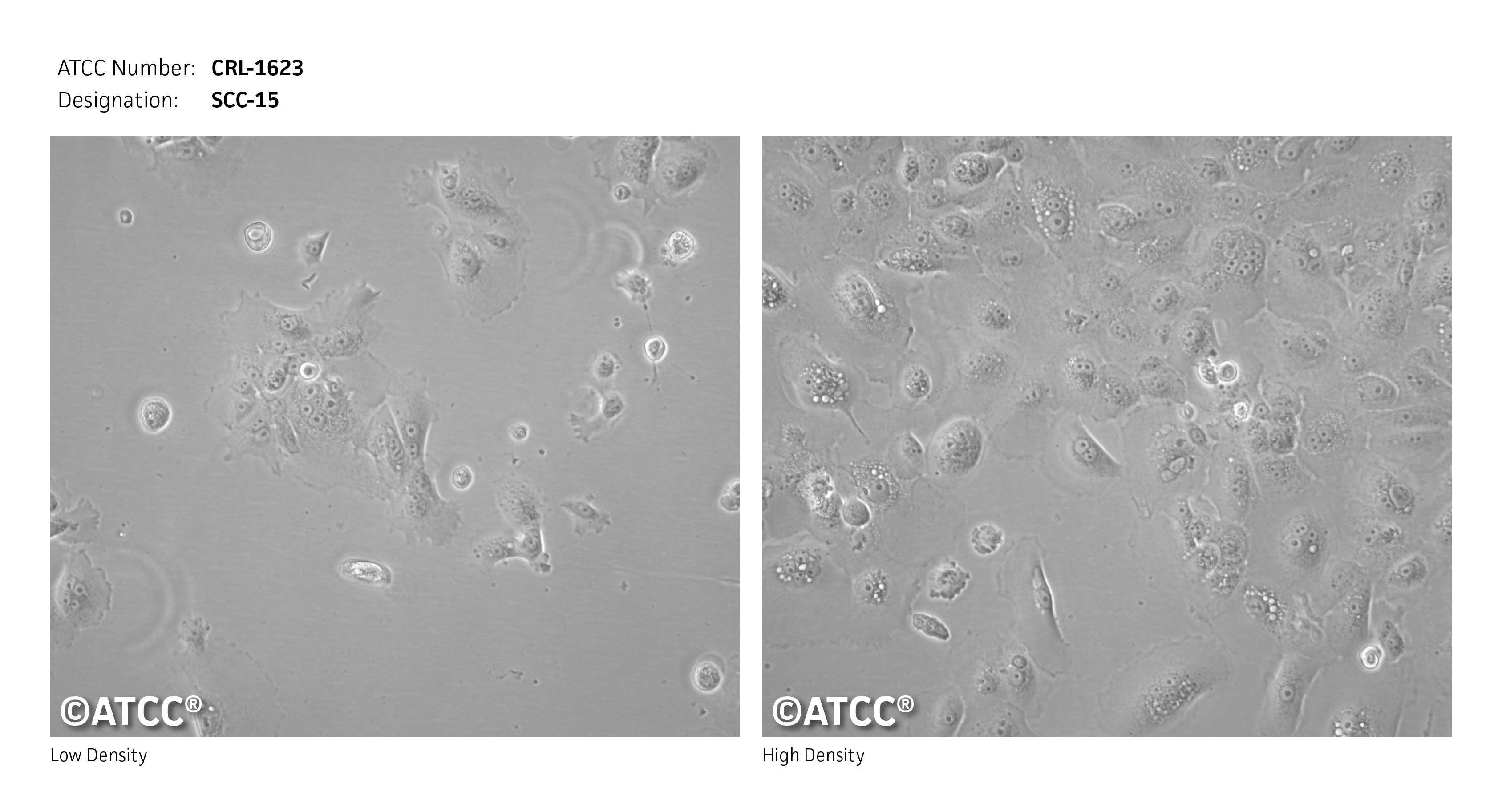 SCC-15 - CRL-1623 | ATCC