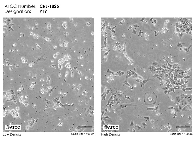 P19 - CRL-1825 | ATCC