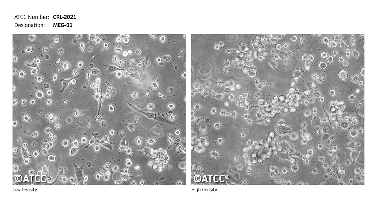 MEG-01 - CRL-2021 | ATCC