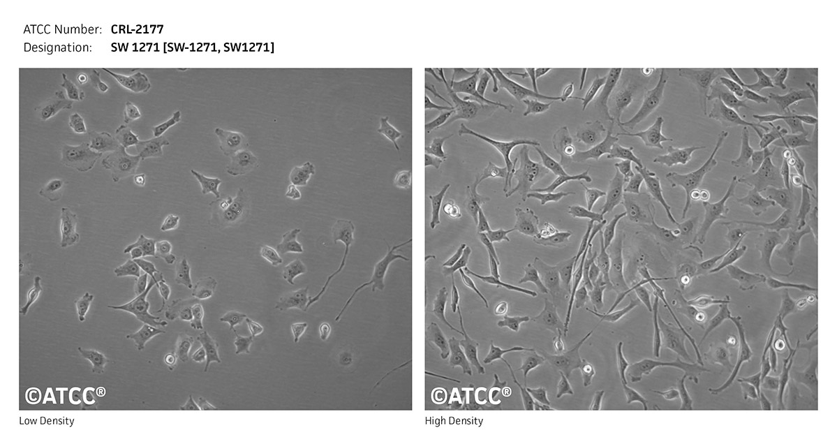 SW 1271 [SW-1271, SW1271] - CRL-2177 | ATCC