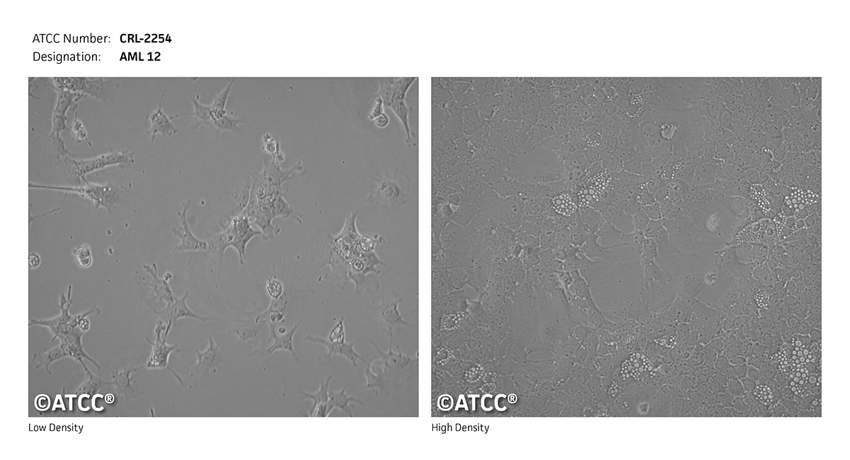 AML12 - CRL-2254 | ATCC