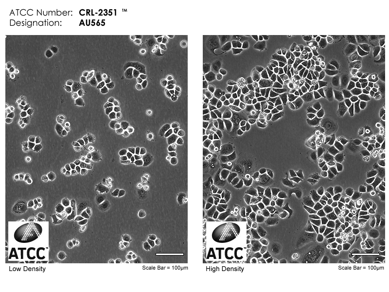 AU565 [AU-565] - CRL-2351 | ATCC