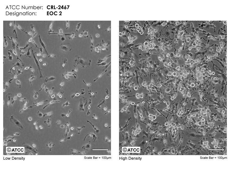 EOC 2 - CRL-2467 | ATCC