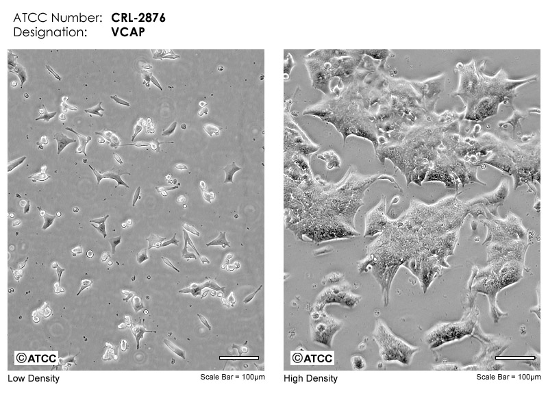 VCaP - CRL-2876 | ATCC