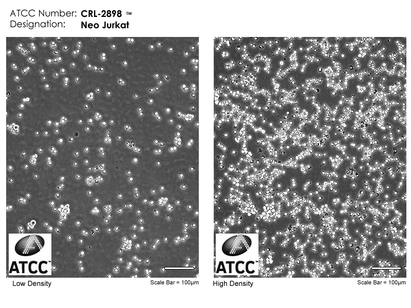Neo Jurkat - CRL-2898 | ATCC