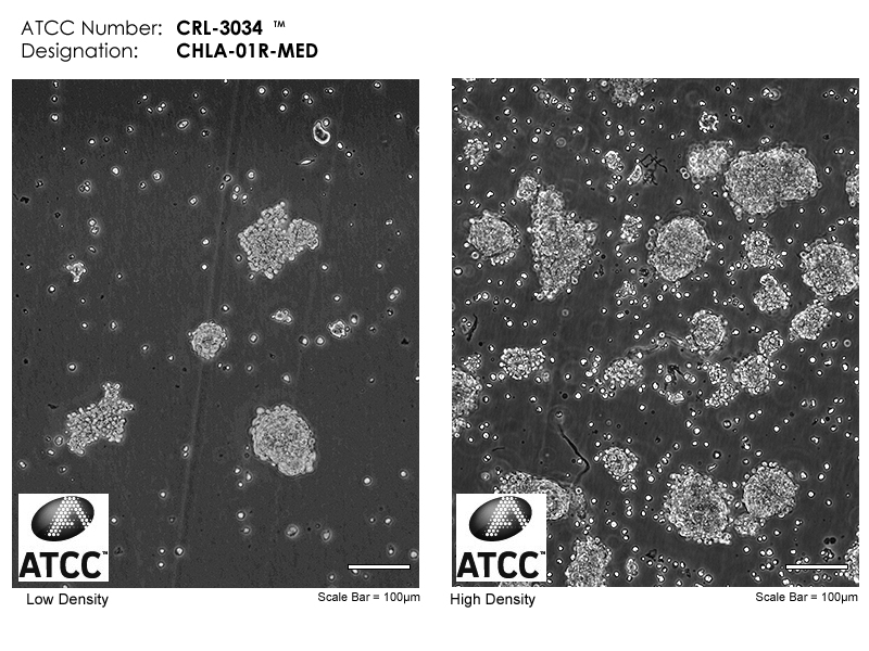 CHLA-01R-MED - CRL-3034 | ATCC