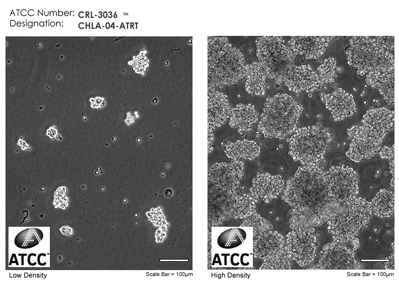 CHLA-04-ATRT - CRL-3036 | ATCC