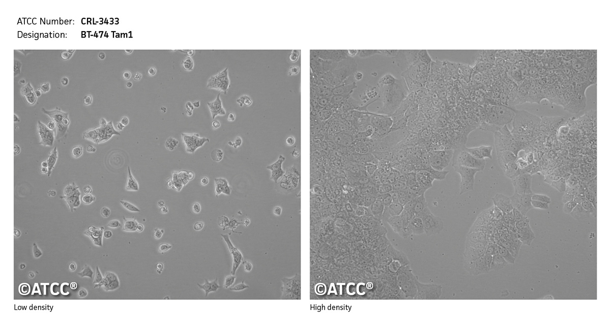BT-474 Tam1 - CRL-3433 | ATCC