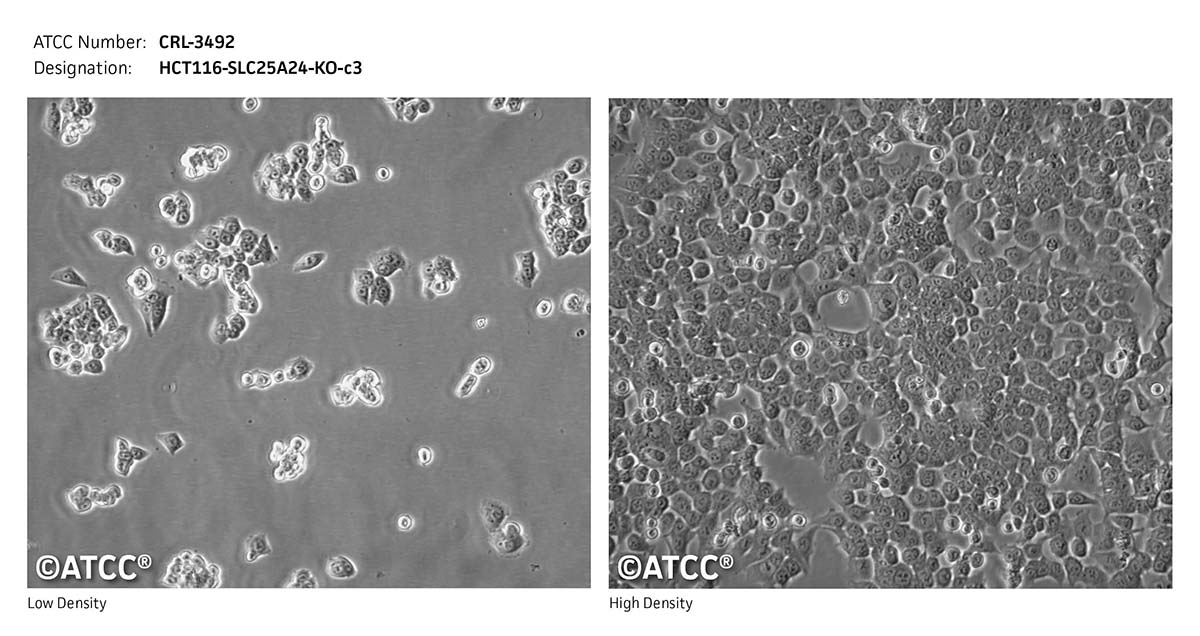 HCT116-SLC25A24-KO-c3 - CRL-3492 | ATCC