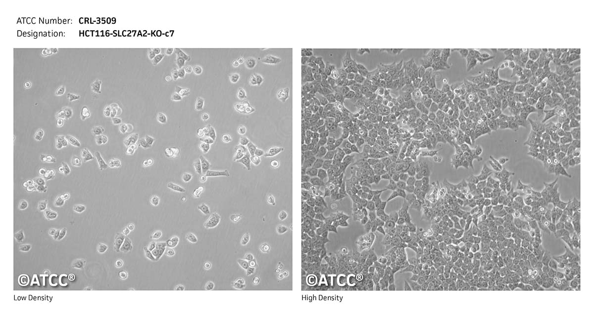 HCT116-SLC27A2-KO-c7 - CRL-3509 | ATCC