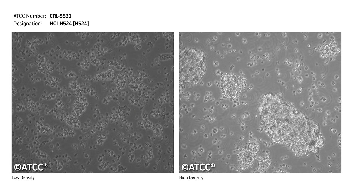 NCI-H524 [H524] - CRL-5831 | ATCC