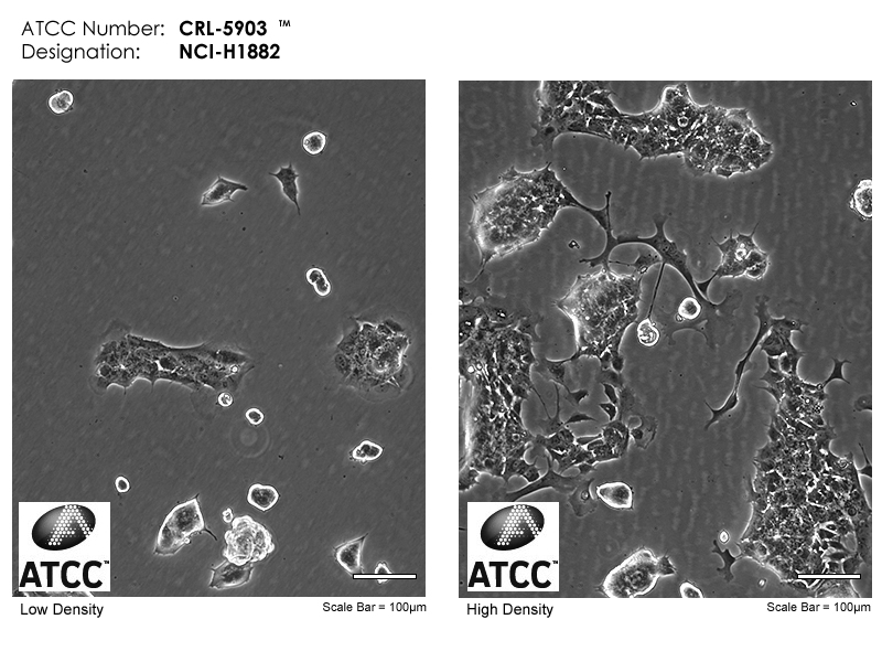 NCI-H1882 [H1882] - CRL-5903 | ATCC