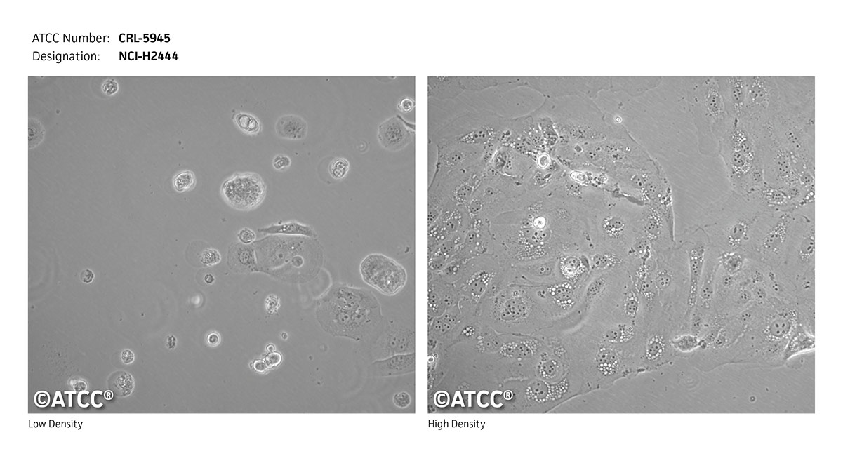 NCI-H2444 [H2444] - CRL-5945 | ATCC