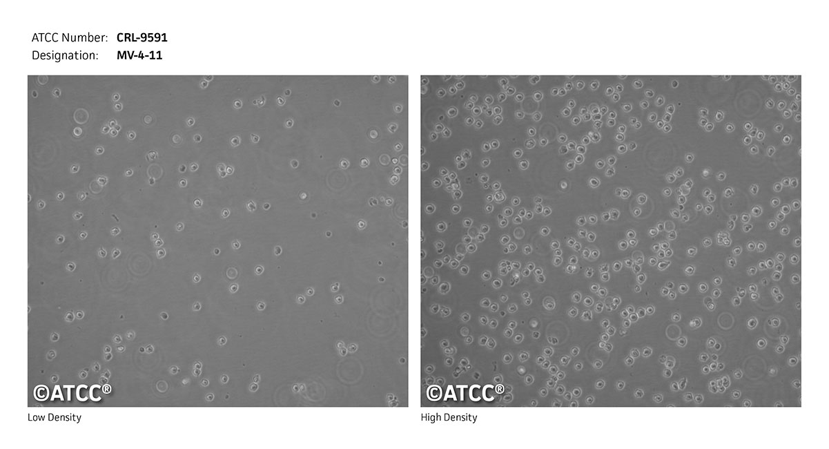 MV-4-11 - CRL-9591 | ATCC