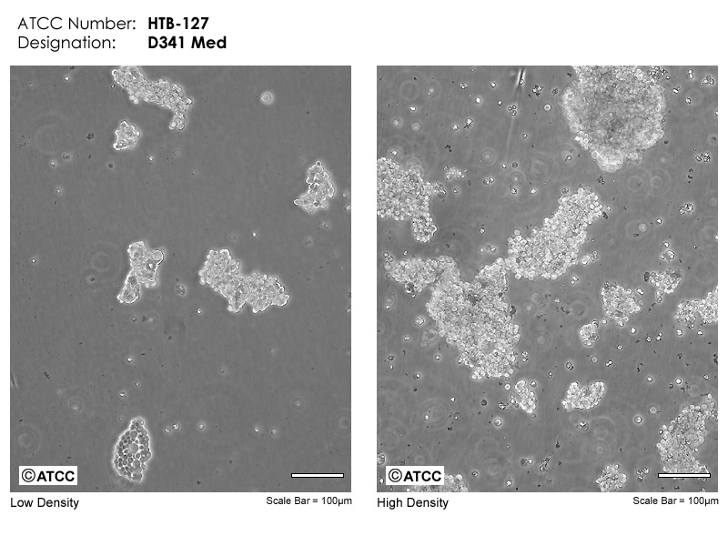 MDA-MB-330 - HTB-127 | ATCC